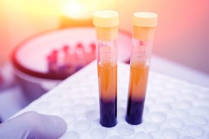 The Ultimate Guide to PRP Therapy | Oregon Regenerative